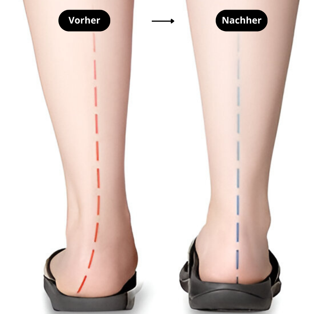KomfortFlex - Orthopädische Einlagen – Nevolta